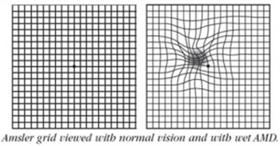 Best Retina Specialist in Bhayendar - Retina Treatment