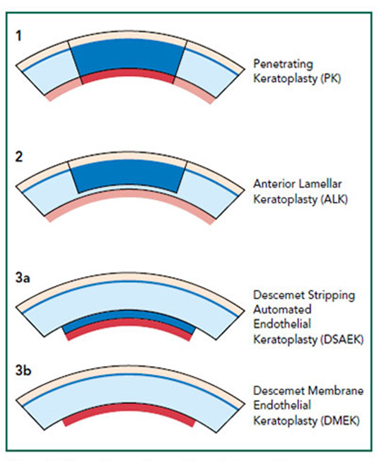 Welcome [www.sanjeevanieye.com]
